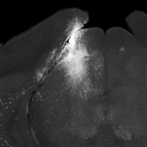 Mouse Superior Colliculus Image Eurekalert Science News Releases