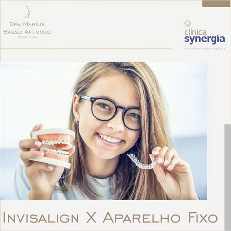 Invisalign X Aparelho Fixo Dra Marilia Basso Affonso
