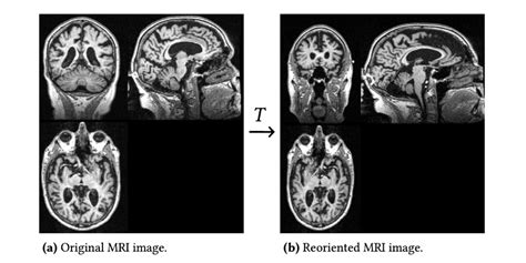 github alexsisay mri retrieval retrieval of brain mri image