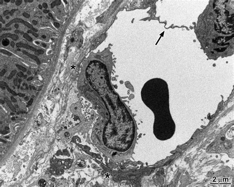 Between The Two Asterisks The Endothelial Cell Layer Is Fragmented And