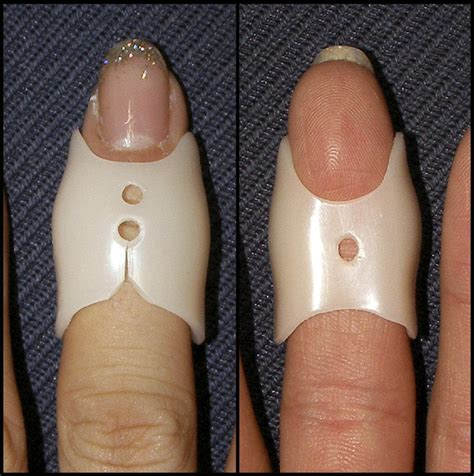 Finger Splint Osteoarthritis At Lola Goll Blog