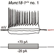 Normal Intrinsic Electrical Properties In Heterozygous STXBP1 Mutant