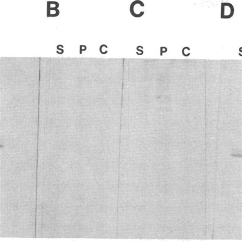 Three Active Zone Proteins Bassoon Piccolo And Rim 1 Had Very