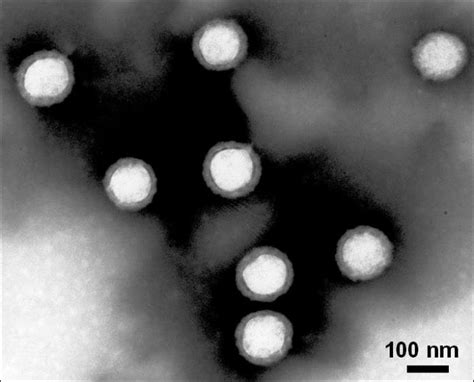 Fig S1 Tem Image Of Core Shell Nanospheres Prepared From Recipe 2 The Download Scientific