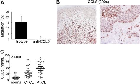 Ccl5 Produced By Malignant T Cells Attracts Monocytes To The Tumor
