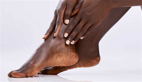 Lightening Dark Feet Effective Solutions And Tips