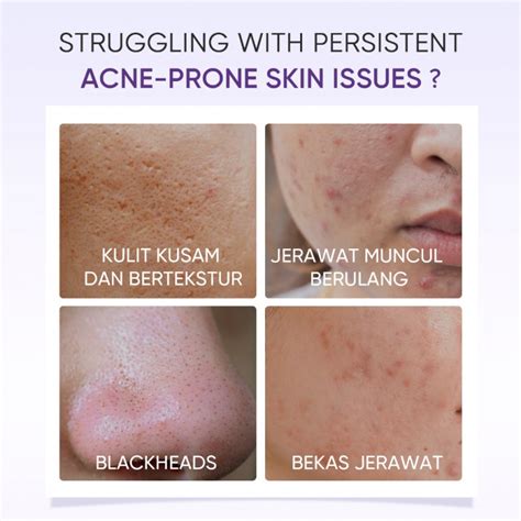 Jual Skintific Lactic Acid Skin Renewal Exfoliating Serum Termurah Juni