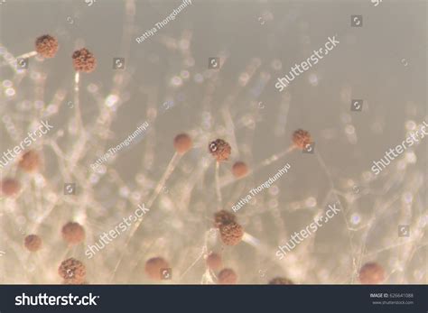 Mold Under Microscope