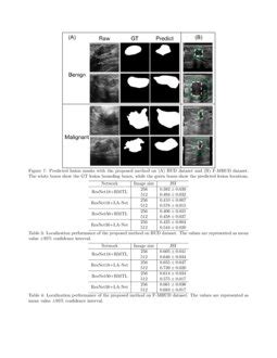 Joint Localization And Classification Of Breast Tumors On Ultrasound
