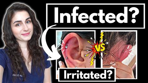 How Does An Infected Helix Piercing Look Like
