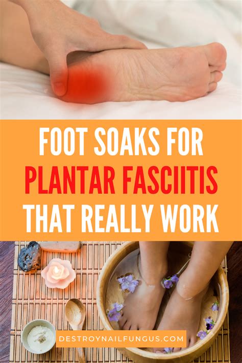 Plantar Fasciitis At Home Treatment At Mary Lockridge Blog