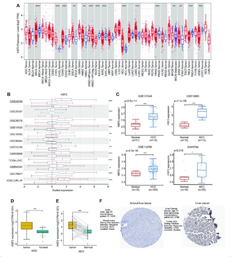 Hsf2 Expression In Hcc A Increased Or Decreased Expression Of Hsf2