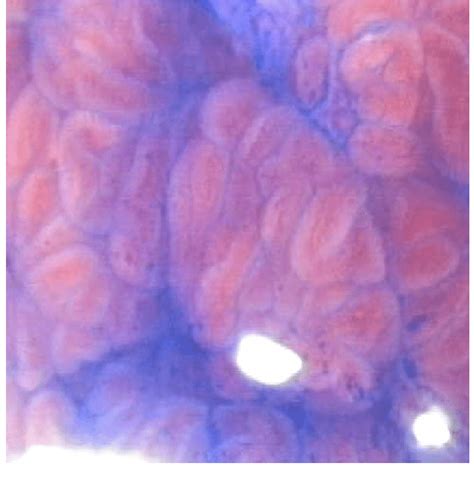 Long Oval Pit Pattern Endos Classification Download Scientific Diagram