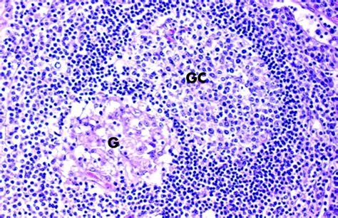 Multiple Sclerosis Research Research Ebv Persistence In B Cells
