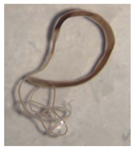 Trichuris Vulpis Floatation With Zinc Sulphate Eggs Of Eucoleus