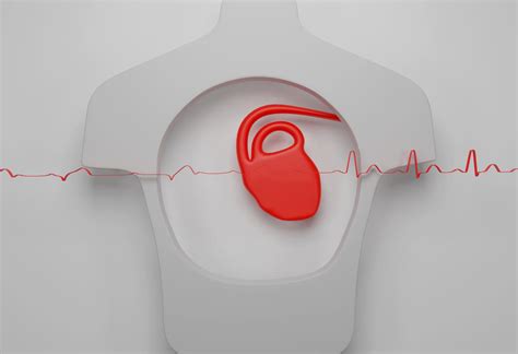 Fibrillation Atriale Si Javais Su Jaurais Eu Recours à Une