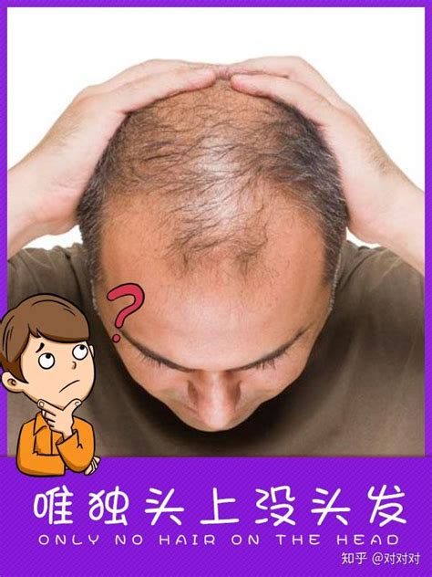 全新tddp植养护体系，为你保发护囊！ 知乎