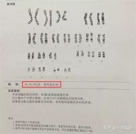 能看懂这些检查结果的请举个手 知乎