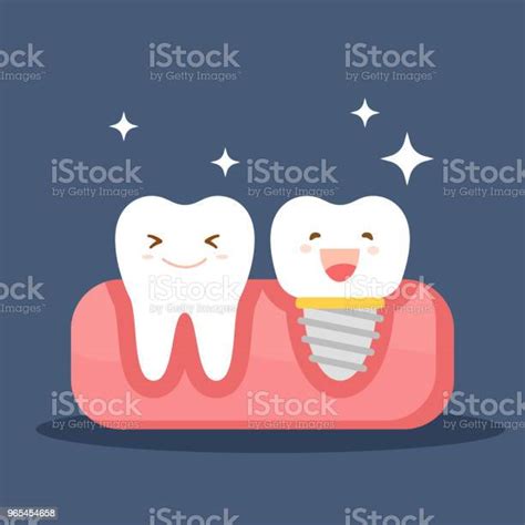 치과 임 플 란 트 하 고 정상적인 치아입니다 구강에 복원입니다 치과의 주제에 평면 그림입니다 벡터 일러스트 파란색 배경에
