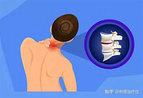 一扭脖子就咔咔响是怎么回事是颈椎问题吗 知乎