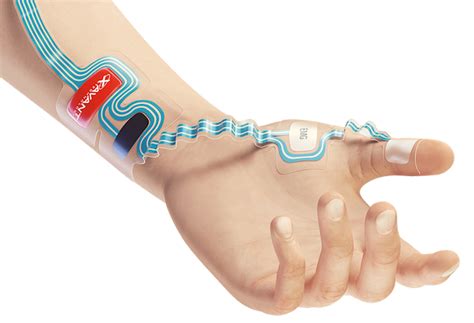 Asa And Easic Guidelines On Monitoring Residual Neuromuscular Blockade Xavant Technology Tof