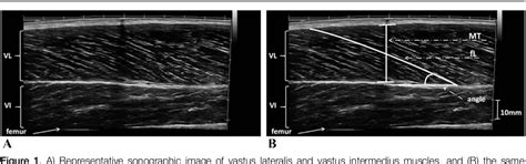 Figure 1 From Effects Of A 25 Week Periodized Training Macrocycle On