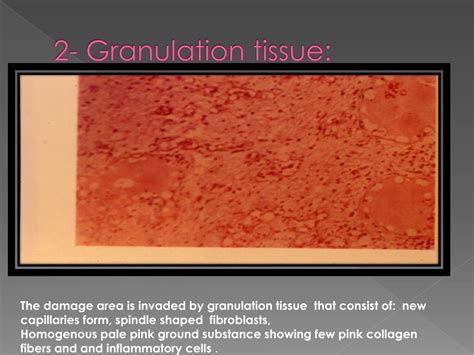 Ppt Healing And Gangrene Powerpoint Presentation Free Download Id