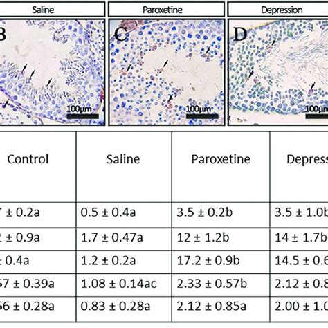 Immunohistochemical Staining Of Tunel Positive Cells In Testes