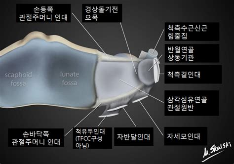 손목의 통증 3 삼각 섬유연골 복합체 Tfcc 손상 네이버 블로그