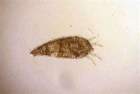 General Shape Of A Lycopersici Under Microscope With Low Magnification