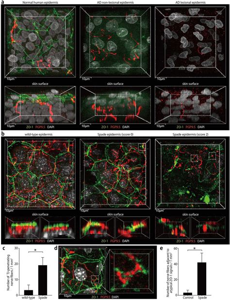 Epidermal Nerve Endings Are Contained Under Tjs In The Normal Human And