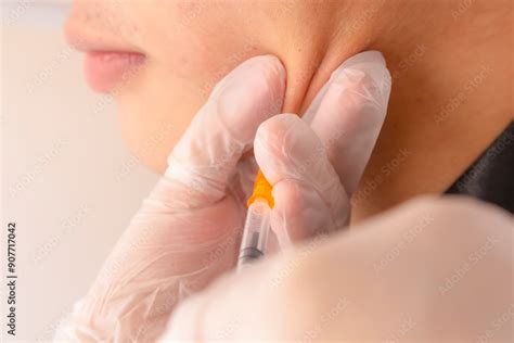 Masseter Jaw Masseter Botulinum Toxin Injection Also Known As Jawtox