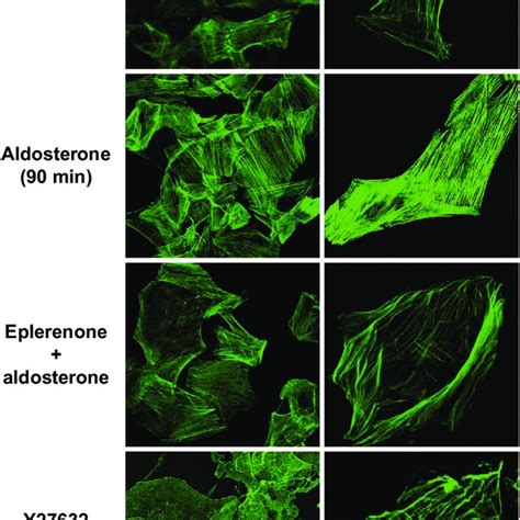 Effect Of Aldosterone On The Reorganization Of The Vascular Smooth