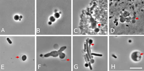 Isolation Of L Form Bacteria From Urine Using Filtration Method
