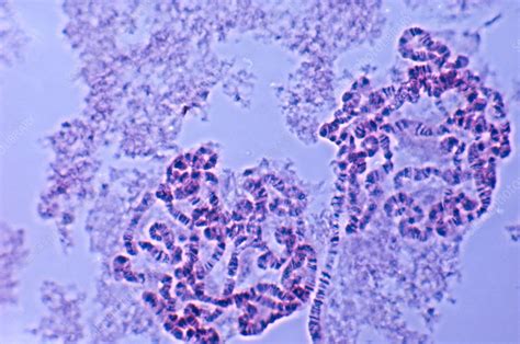 Fruit Fly Salivary Glands Stock Image Z3400650 Science Photo Library
