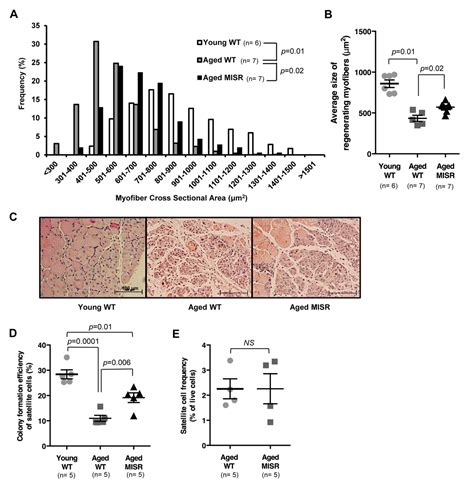 Age Associated Nf κb Signaling In Myofibers Alters The Satellite Cell