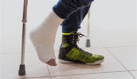 Arthroscopicanklesurgery Neal Jacobs