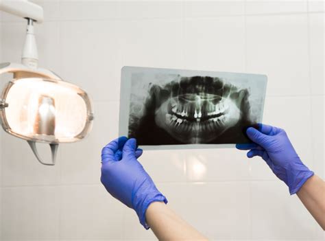 치과 전문의 치과에는 11개의 전문 분과가 있습니다 구강외과 보철과 보존과 소아치과 치주과 교정과 구강내과 예방치과 등 By 닥터자일리톨 네이버 블로그