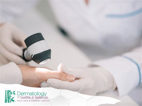 Is Squamous Cell Carcinoma Hereditary Dermatology Of Seattle And Bellevue