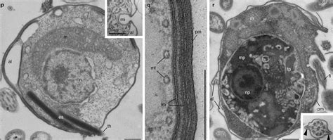 A New Supergroup Of Predatory Eukaryotic Microbes Has Been Identified
