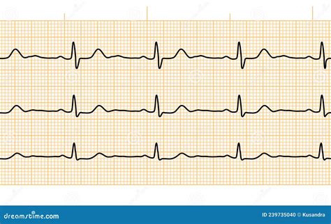 Ecg Test Or The Cardiac Test Cartoon Vector 75168841