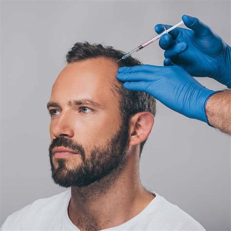 PRP Scalp Therapy Arlington VA KenshŌDerm