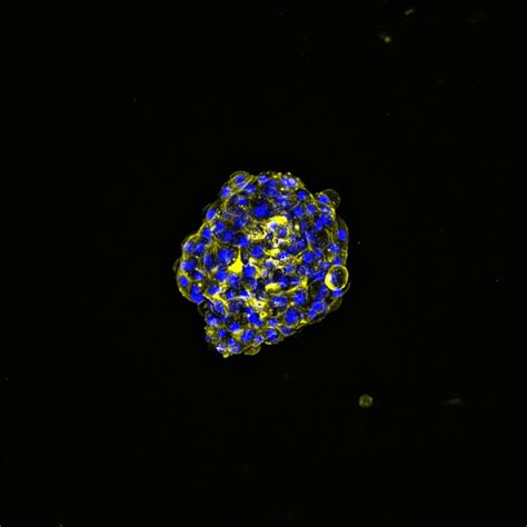 Using Crispr Technology Scientists Have Created Transplants Of Pancreatic Cells That Can Treat