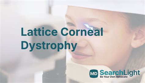 Lattice Corneal Dystrophy Md Searchlight