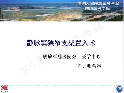 静脉窦狭窄支架置入术