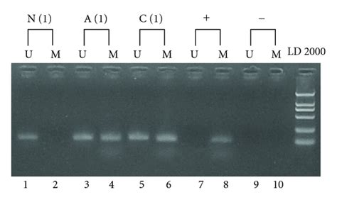 Methylation Of The Apc Promoter Was Exclusively Identified In The