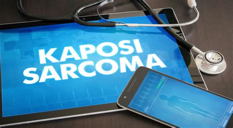 Kaposi Sarcoma Drluigi