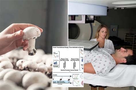Mushroom Extract Shows Promise In Slowing Prostate Cancer Growth In New