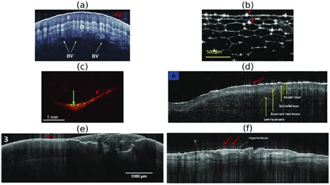 Published Image Examples Containing Prominent Sidelobe Artefacts Download Scientific Diagram