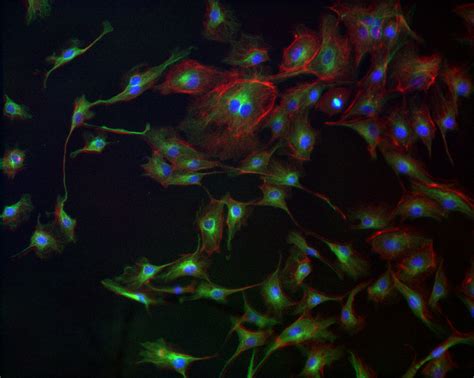 Optimizing Fluorescence Microscopy Exploiting The Benefits Of Broadly